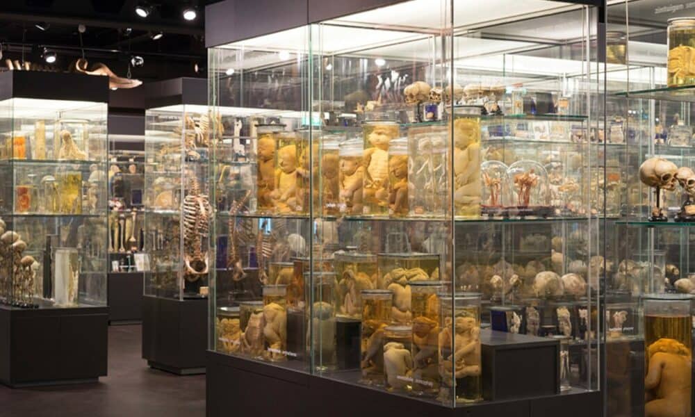 Museo Vrolik: El lado espeluznante de Ámsterdam | El Souvenir