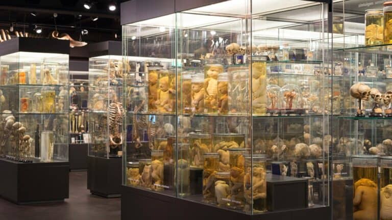 Museo Vrolik: El lado espeluznante de Ámsterdam | El Souvenir